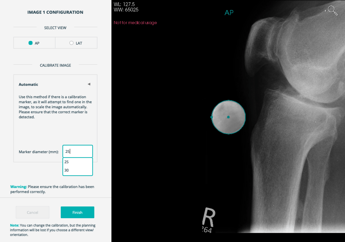 Calibrate/configure the image