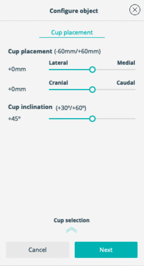 Total Hip Arthroplasty: How to perform