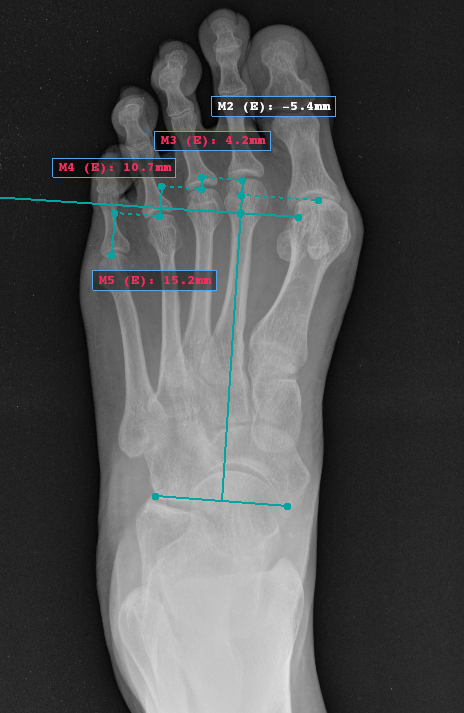 Fórmula Maestro: Como realizar