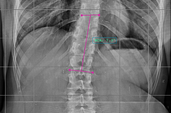 Einzelner Cobb-Winkel: Wie man es ausführt